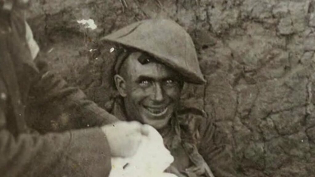 Shell Shock: la patologia dietro una delle fotografie più famose della ...